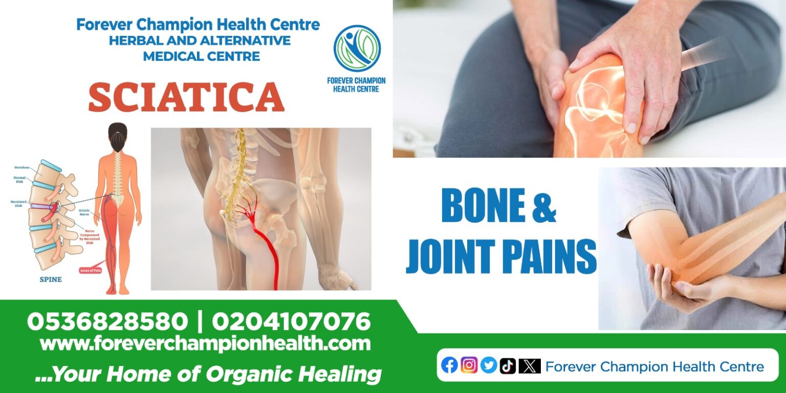 SCIATICA - Diagnosis, Symptoms & Treatment - Forever Champion Health Centre