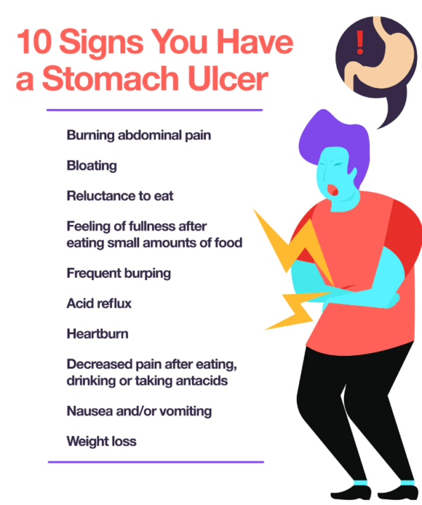 STOMACH ULCER- CAUSES, SYMPTOMS AND TREATMENT - Forever Champion Health ...