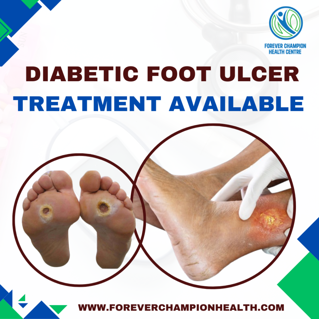 Diabetic Foot Ulcer(Sore) - Forever Champion Health Centre
